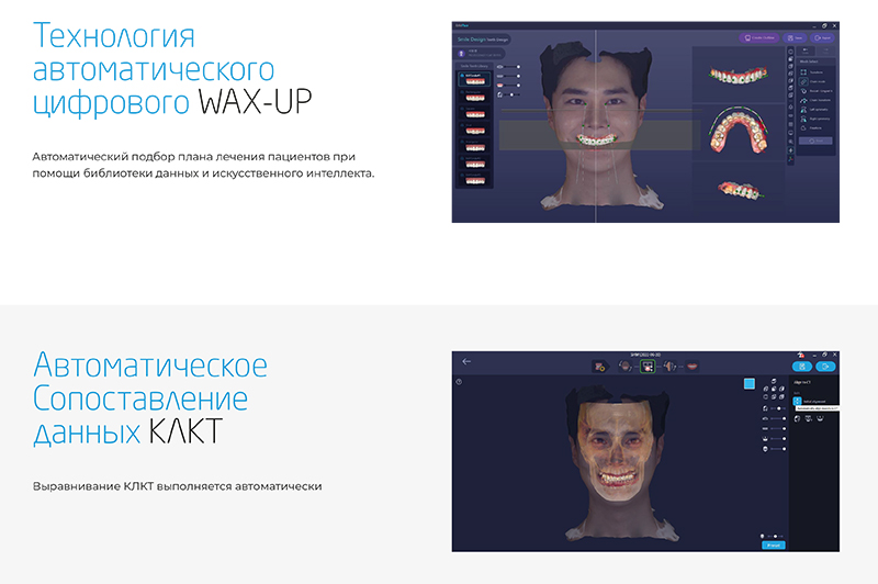 Каталог Ray RAYFace – 3D сканер лица от магазина Udentis.ru