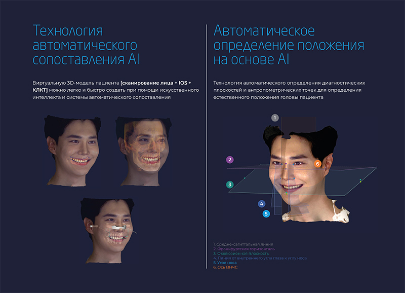 Каталог Ray RAYFace – 3D сканер лица от магазина Udentis.ru